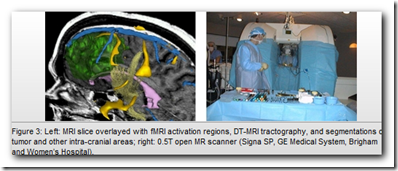 3D Slicer – Open Source Software for CT and MRI Radiology - Medical Quack